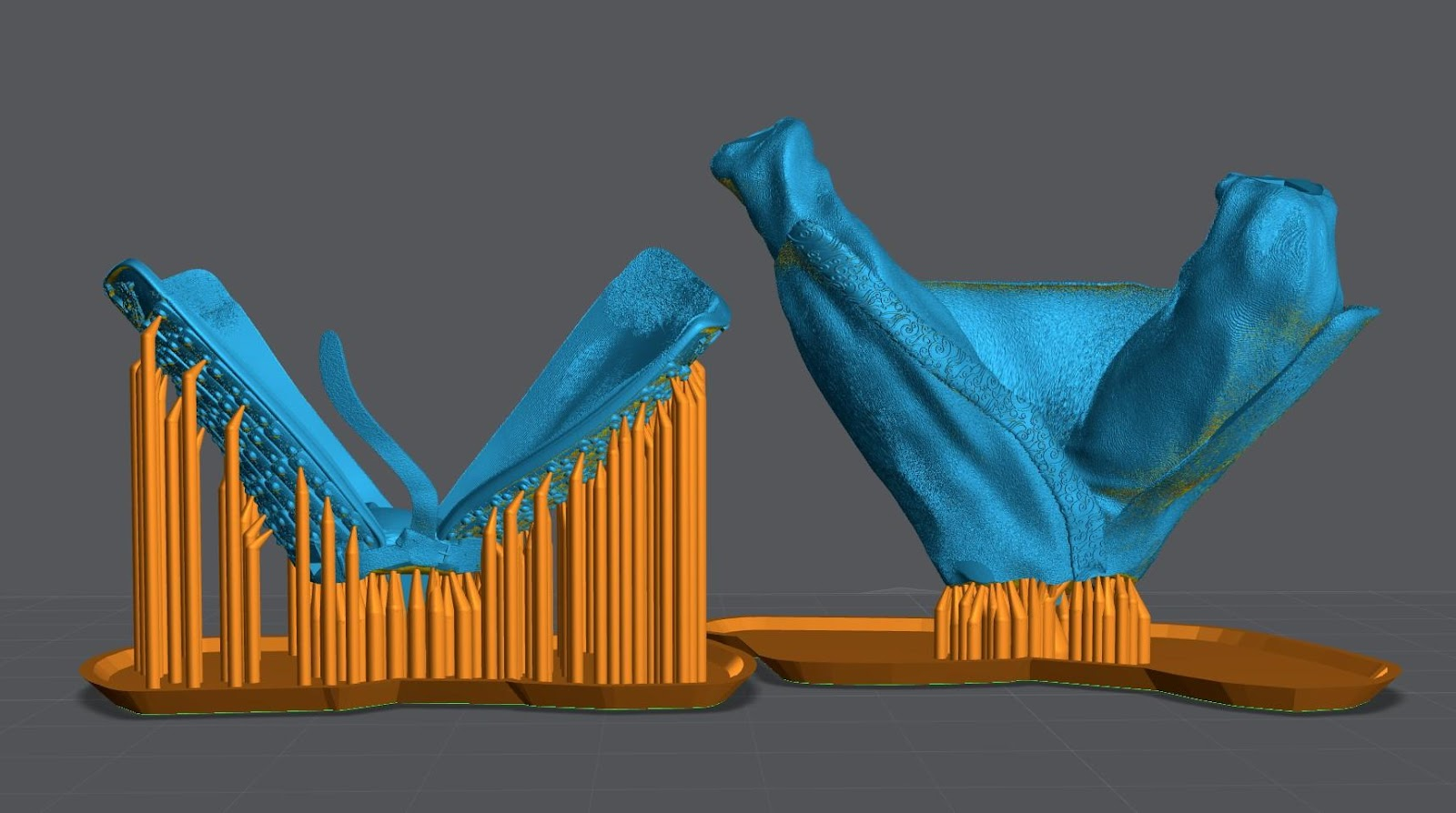 Advanced Supporting – Lychee Documentation